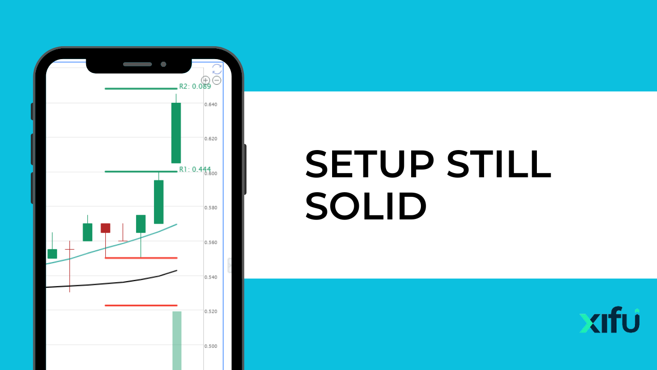 Xifu: Investing Together